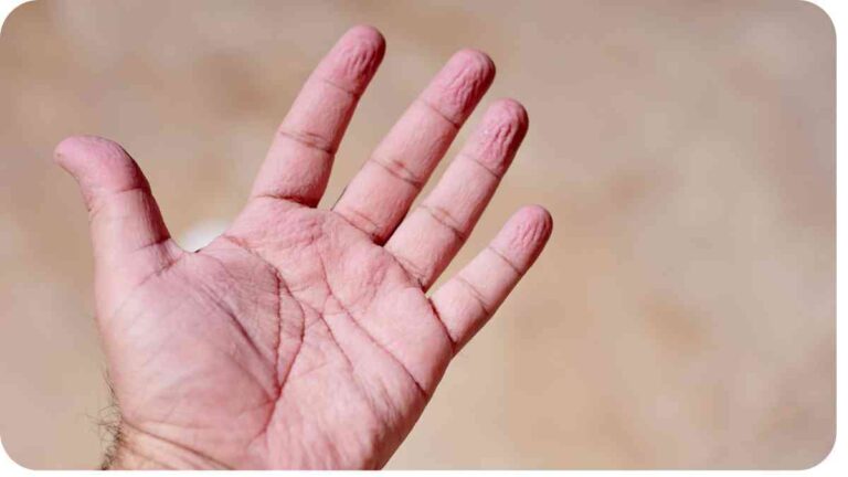 What's the Science Behind Pruney Digits from Waterlogging? | Unified Garden