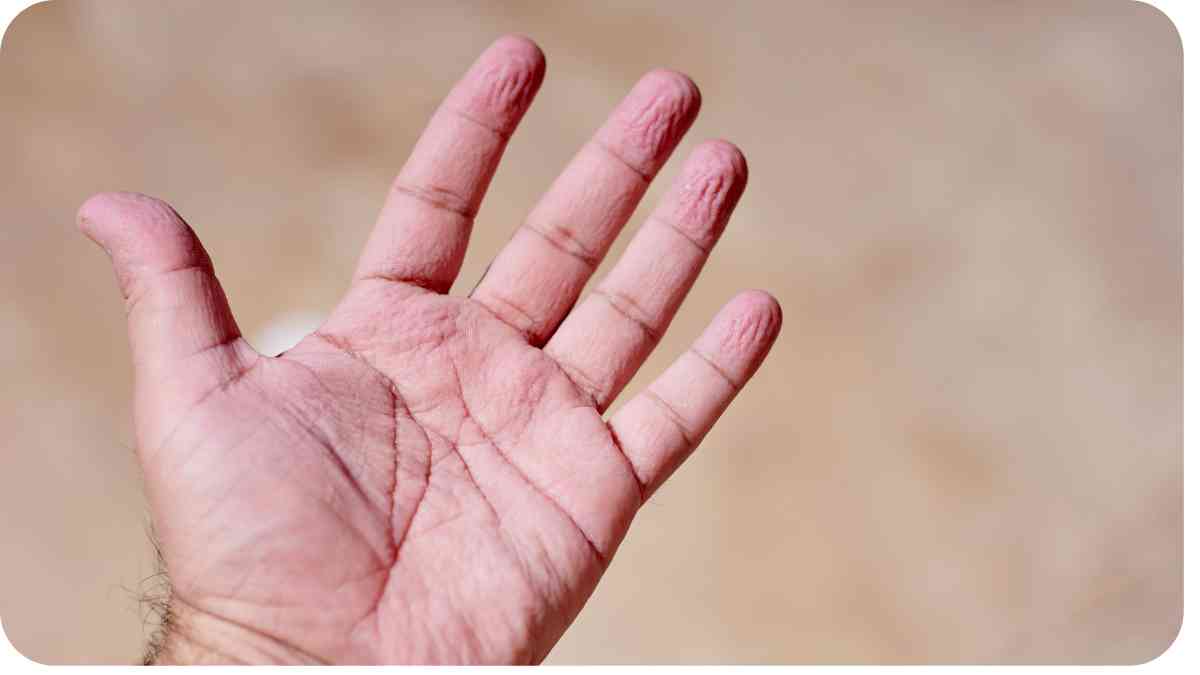 What's the Science Behind Pruney Digits from Waterlogging? | Unified Garden